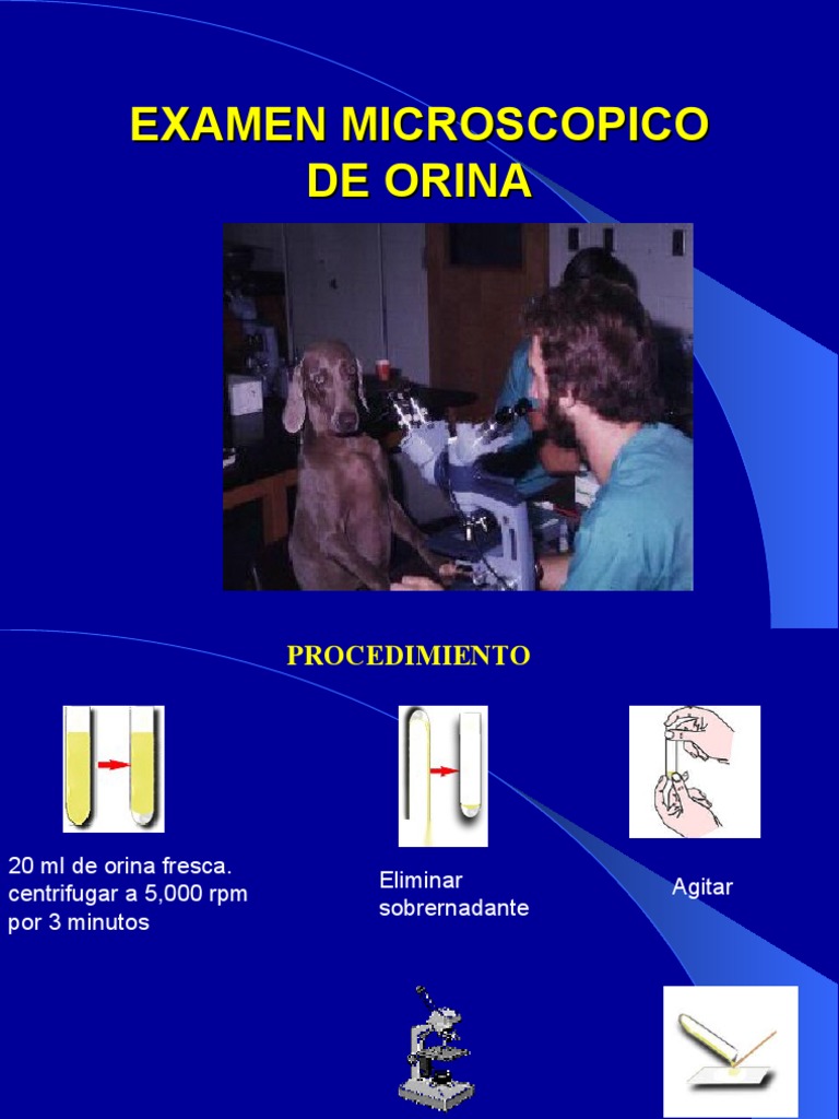 Examen Microscopico | PDF | Orina | Glóbulo rojo
