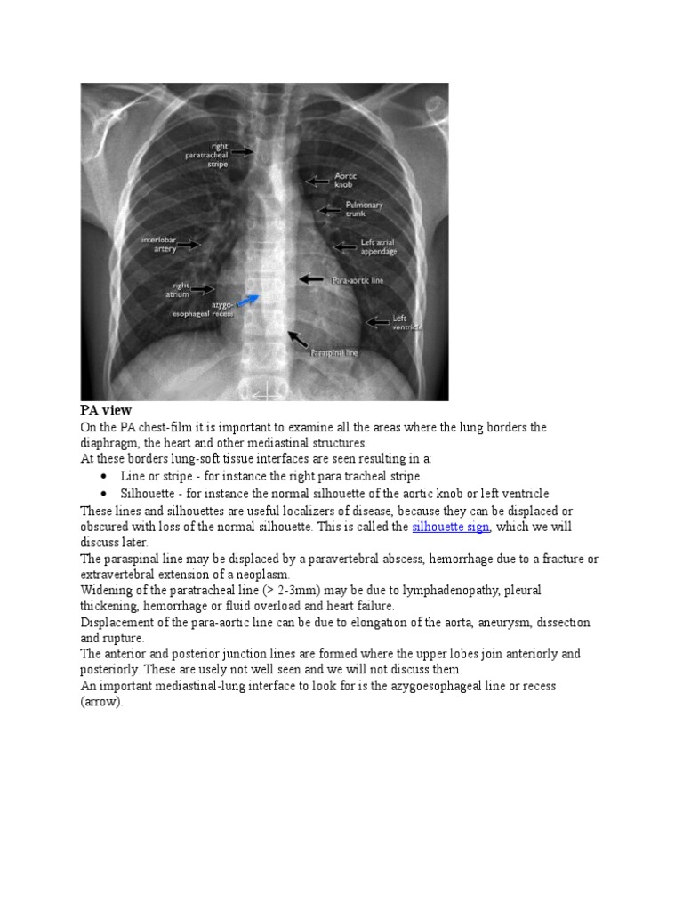 Chest Radiology | PDF