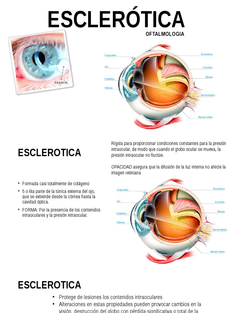 6. Esclerotica | Ojo humano | Oftalmología
