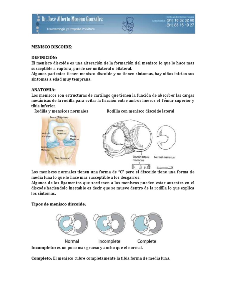 Menisco Discoide | PDF | Rodilla | Sistema musculoesquelético