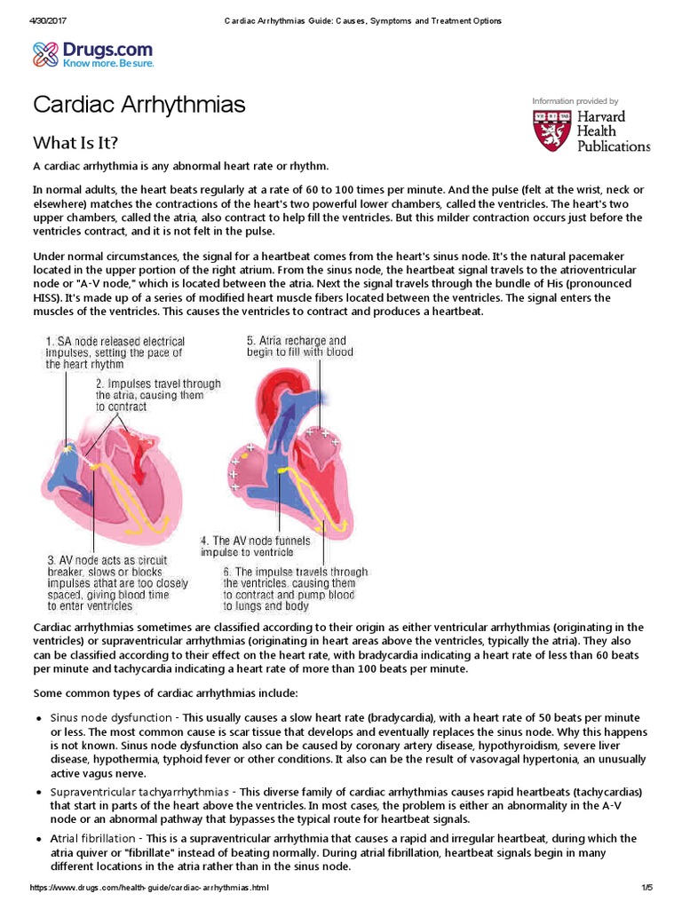 Cardiac Arrhythmias: What Is It? | Cardiac Arrhythmia | Heart