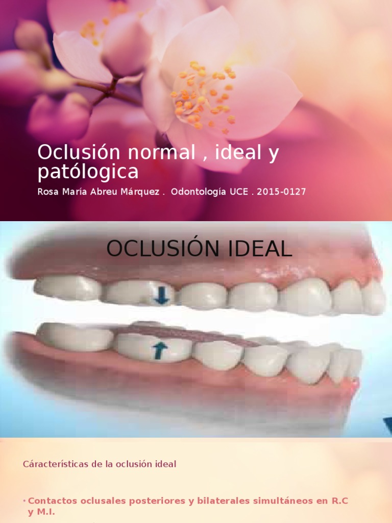 Oclusión Normal , Ideal y Patólogica | Diente humano | Anatomía humana ...