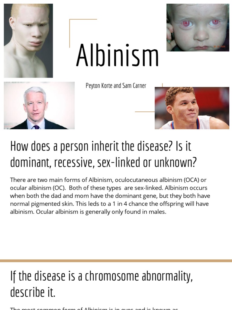 Albinism | PDF | Diseases And Disorders | Medical Specialties