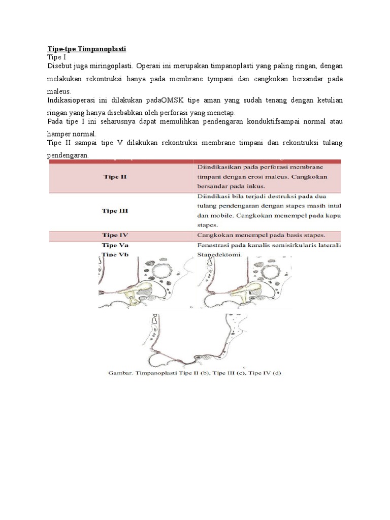 Tipe Timpanoplasti | PDF