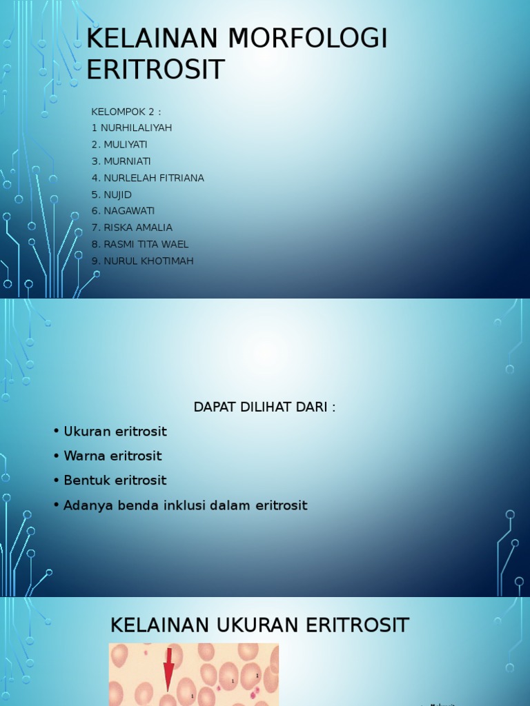 Kelainan Morfologi Eritrosit | PDF