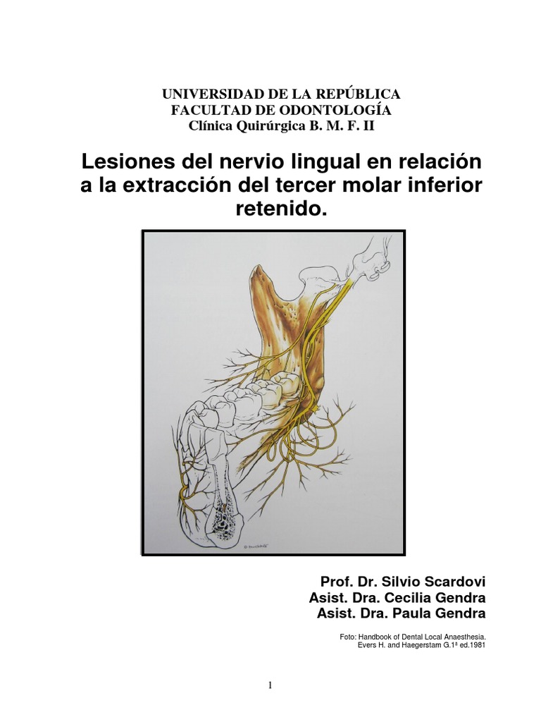 Nervio Lingual | Axon | Dolor