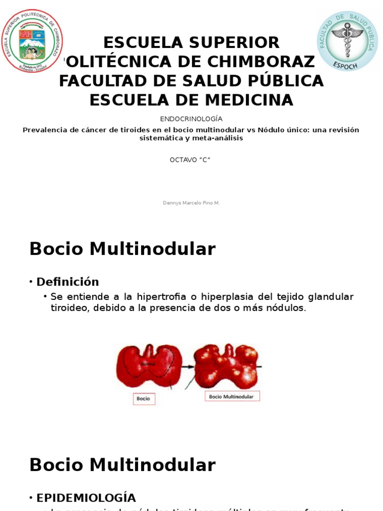 Bocio Multinodular | PDF | Hipertiroidismo | Tiroides