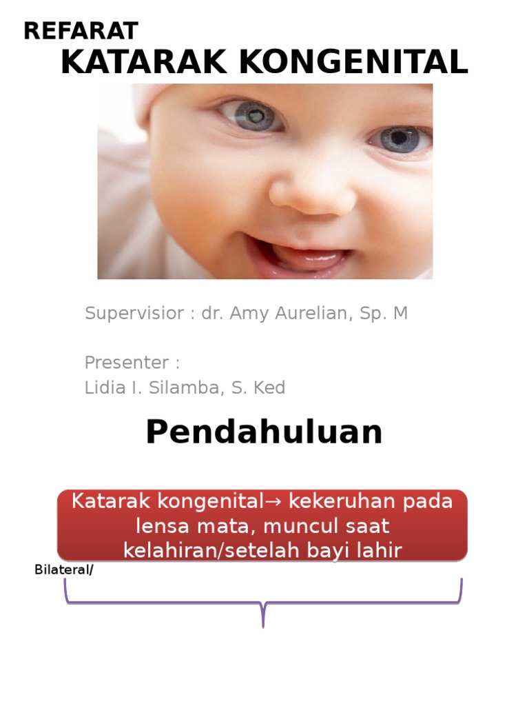 KATARAK KONGENITAL - Lidia Silamba | PDF