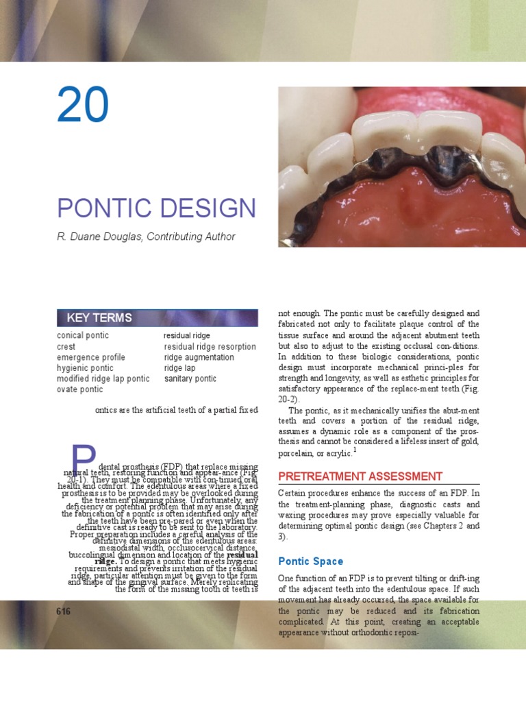 20 Pontic Design | Oral Hygiene | Dental Implant