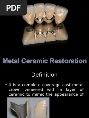 Metal Ceramic Crown Layers