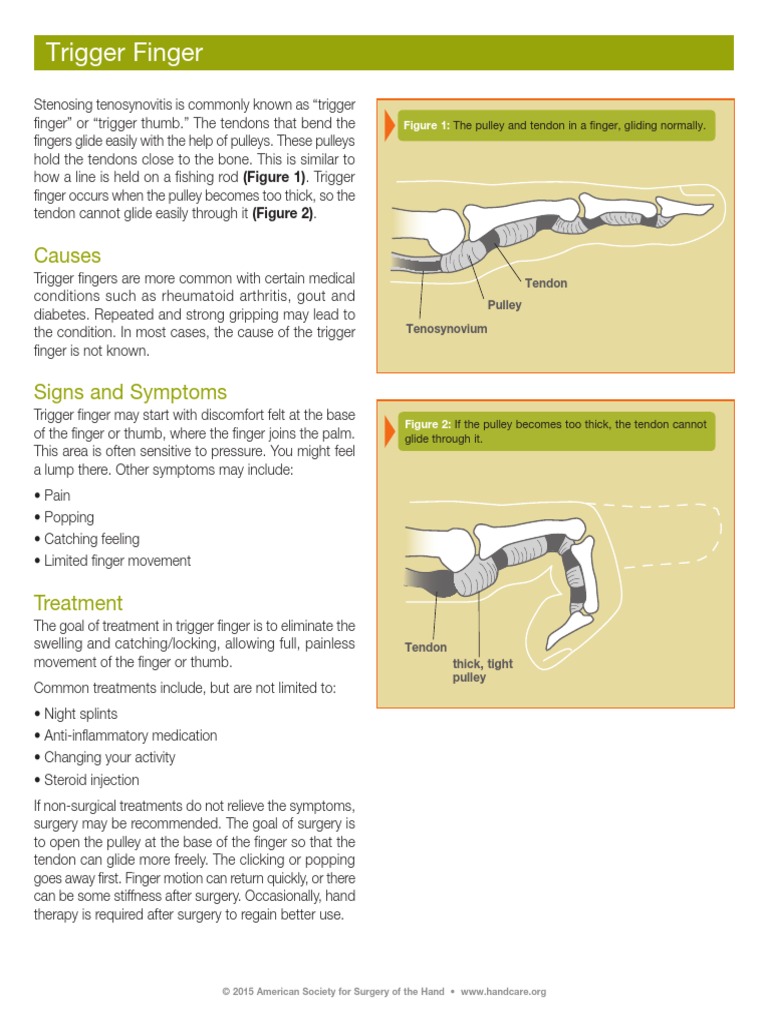 TriggerFinger PDF | PDF