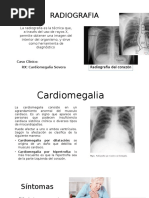 Ejemplo RX Torax Normal | PDF
