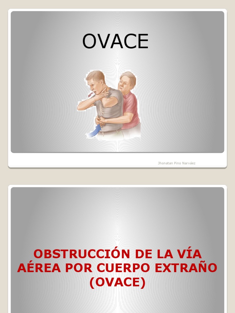 Ovace | PDF | Especialidades Medicas | Medicina CLINICA