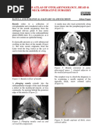 Radial Free Forearm Flap - RFFF - Surgical Technique | PDF