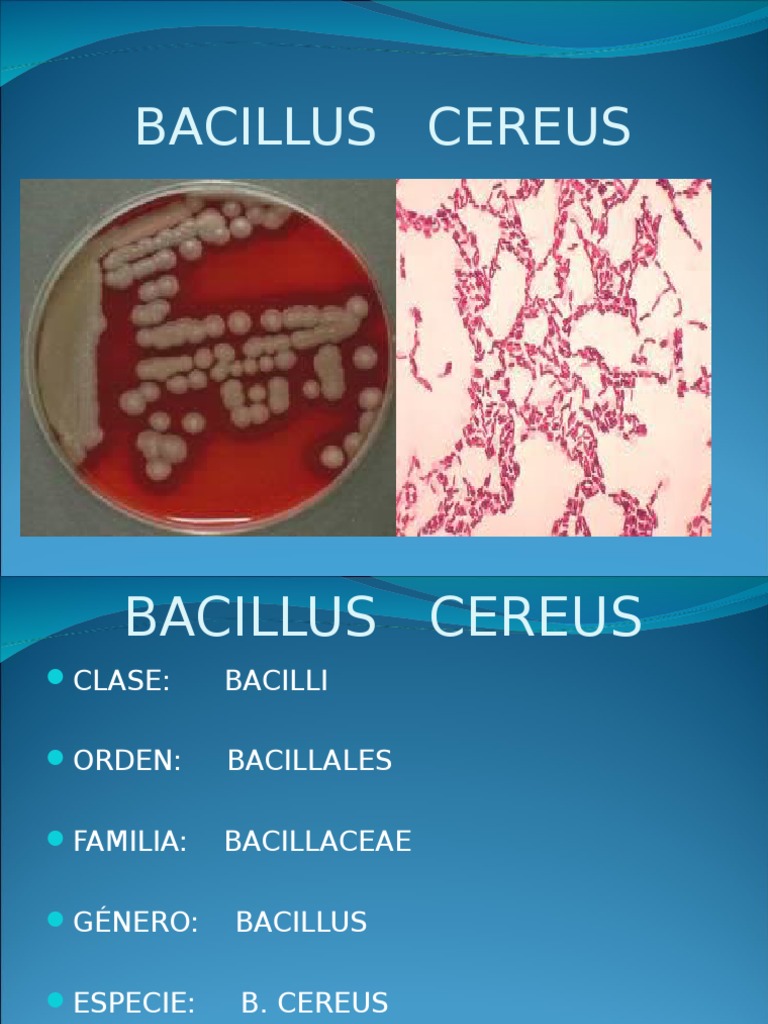 8 Bacillus Cereus (1) | Enfermedades transmitidas por los alimentos ...