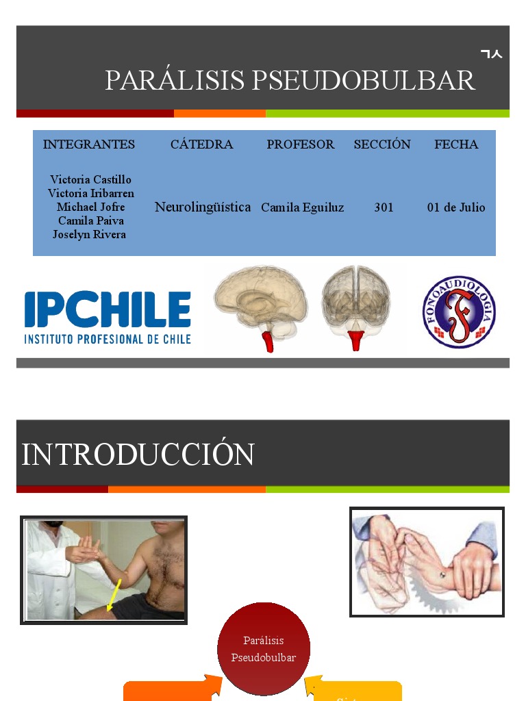 Paralisis Pseudobulbar | PDF | Neurología | Enfermedades y trastornos