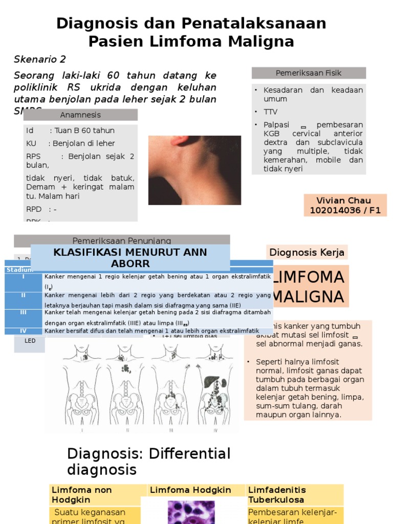 Limfoma Maligna - VC | PDF