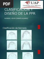 Principios PPR Apoyos, Retenedor Directo e Indirecto | PDF | Dentadura ...