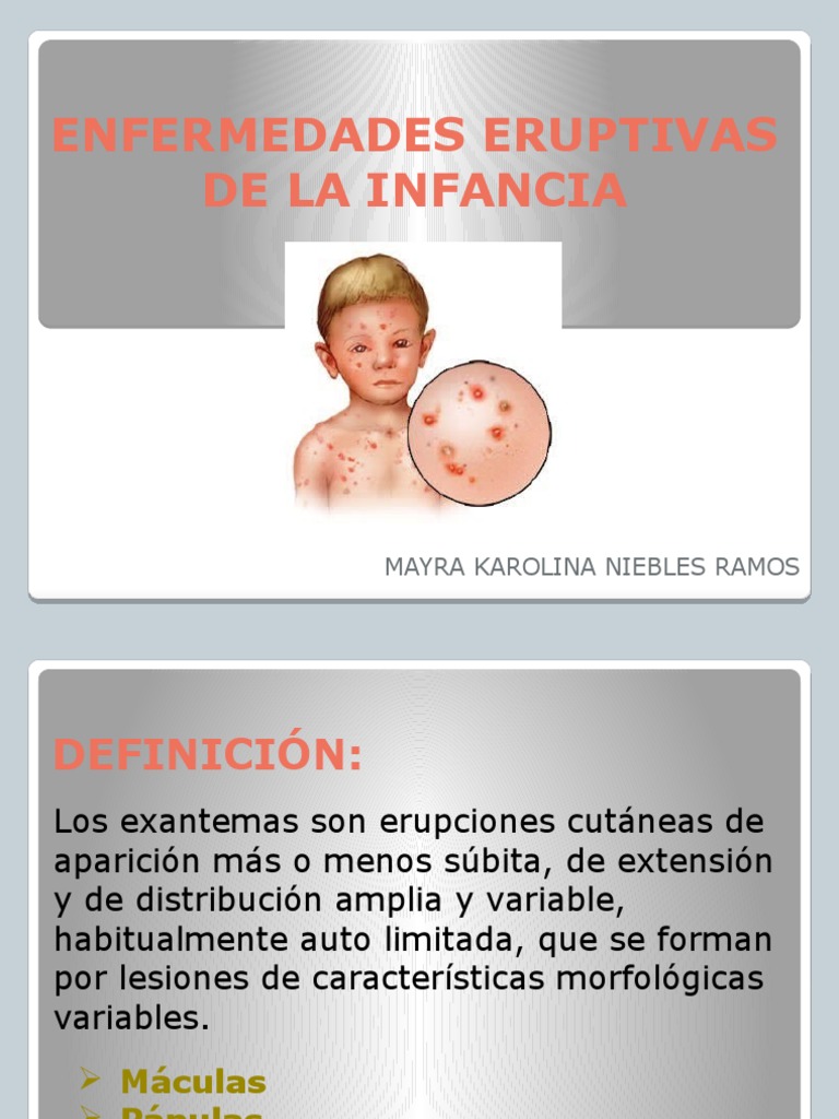 Enfermedades Eruptivas en Niños | PDF | Virología | Inmunología