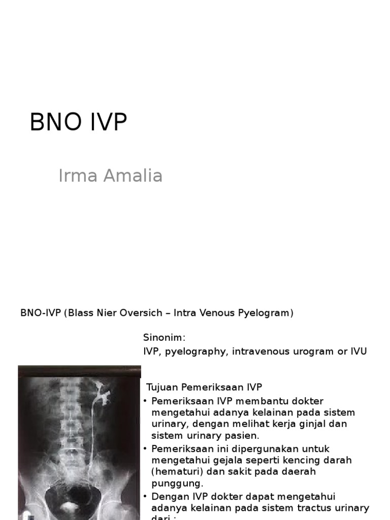 Bno Ivp | PDF