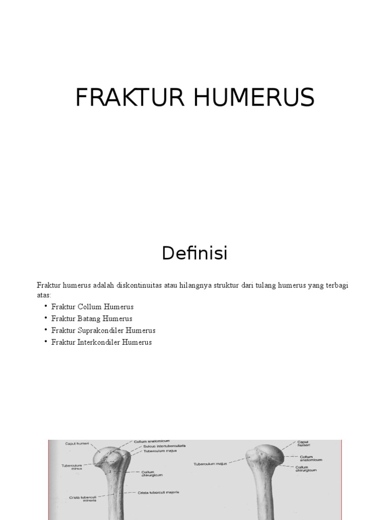Klasifikasi dan Penanganan Fraktur Humerus | PDF | Ilmu Sosial | Sejarah