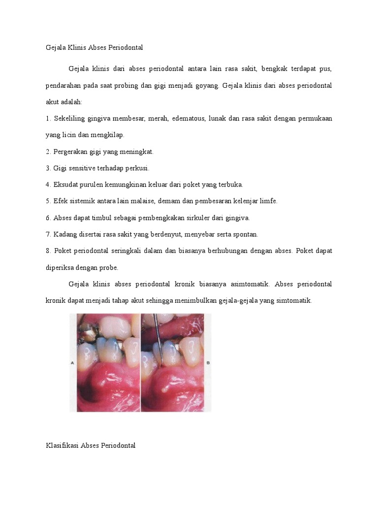 Gejala Klinis Abses Periodontal | PDF