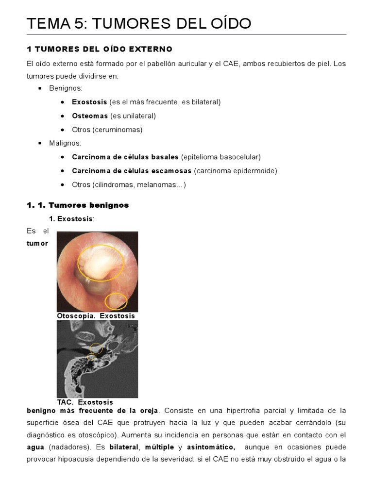 Tema 5 Tumores de Oído | Cáncer | Medicina CLINICA