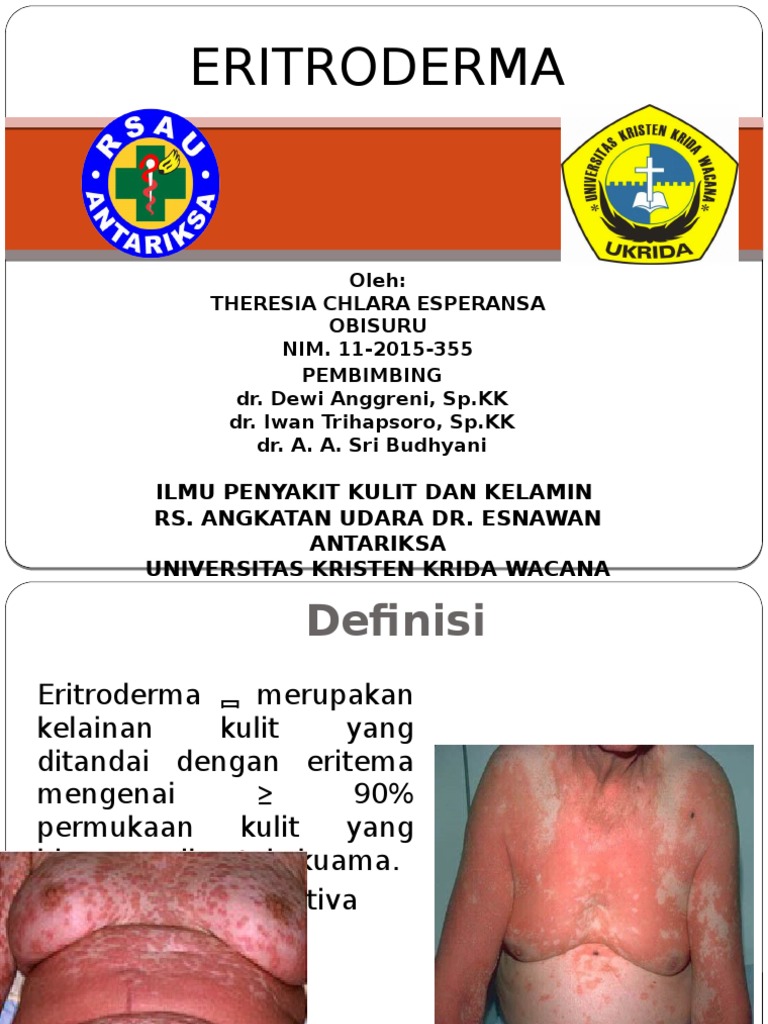 Eritroderma | PDF