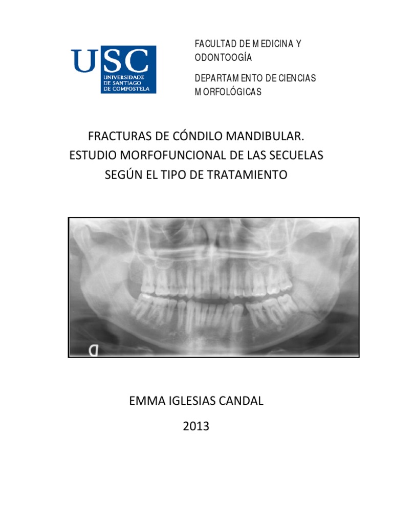 Fracturas de cóndilo mandibular: estudio y tratamiento | PDF ...