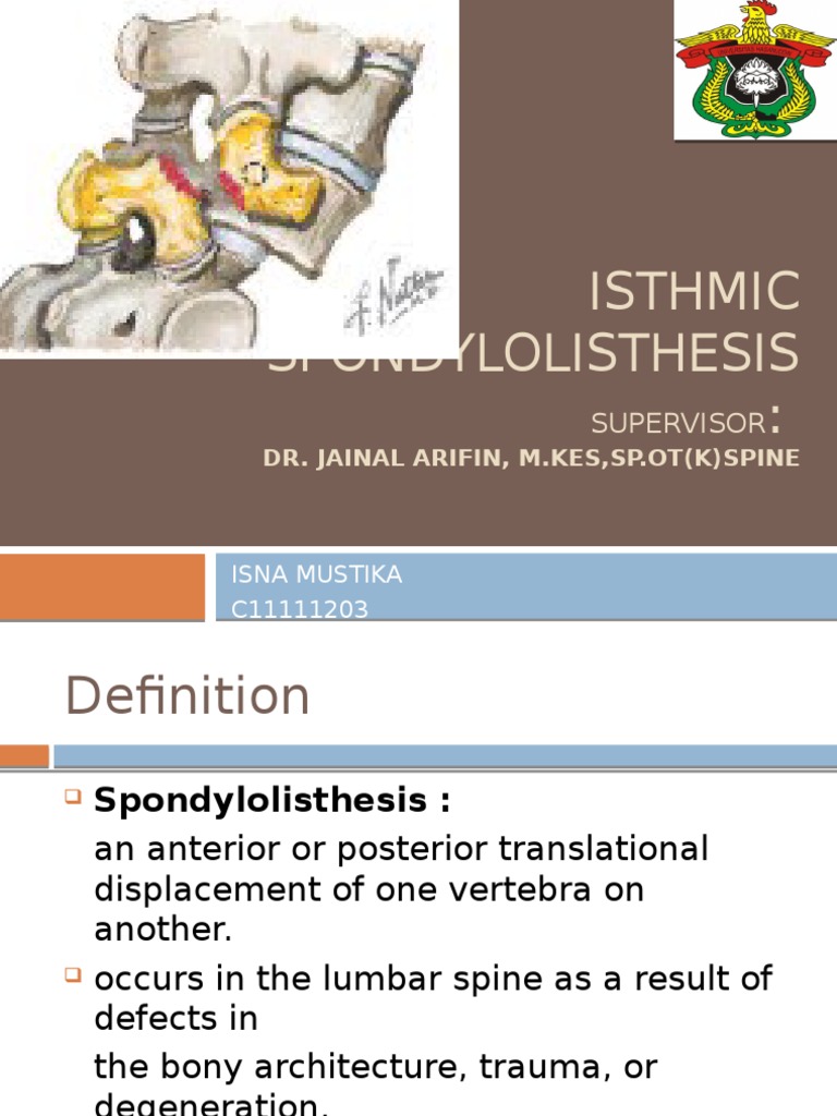 Adult Isthmic Spondylolisthesis | PDF | Vertebral Column | Neurological ...
