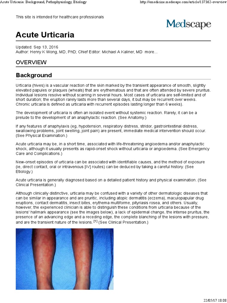 Acute Urticaria: Overview and Pathophysiology | PDF | Allergy | Immunology
