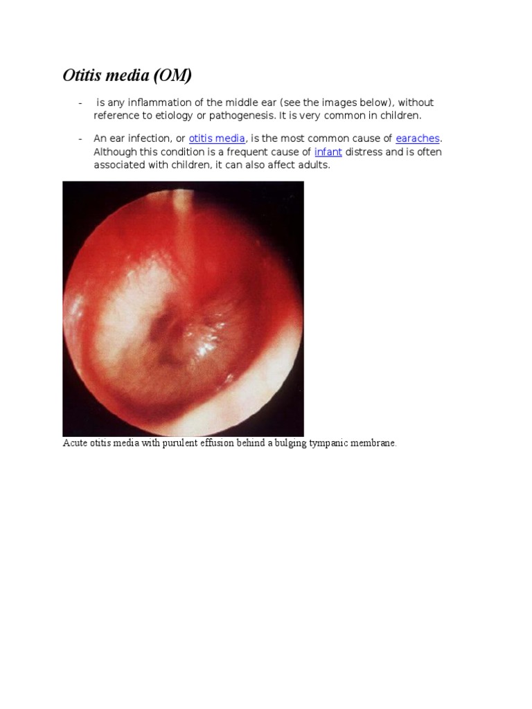Otitis Media | PDF | Medicine | Diseases And Disorders