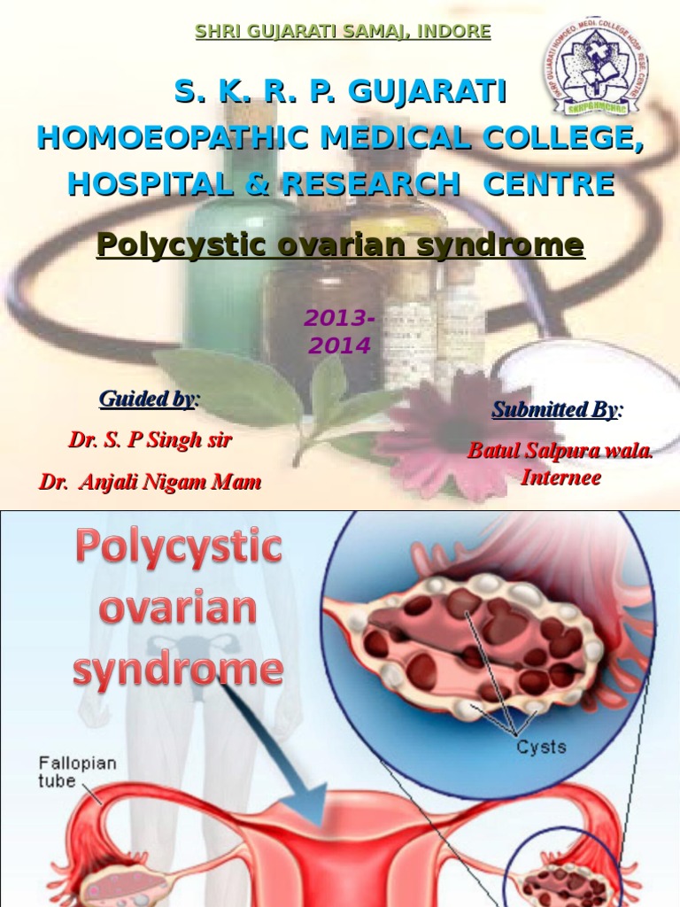 PCOD | Download Free PDF | Polycystic Ovary Syndrome | Endocrine System