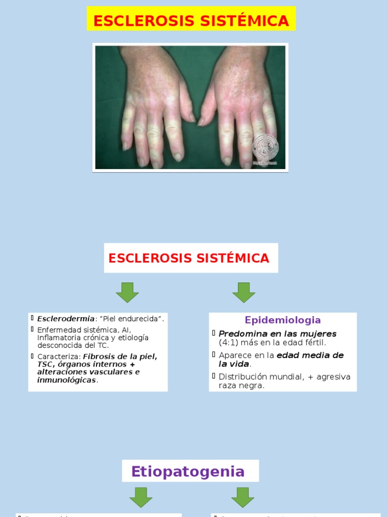 Esclerosis Sistemica | PDF