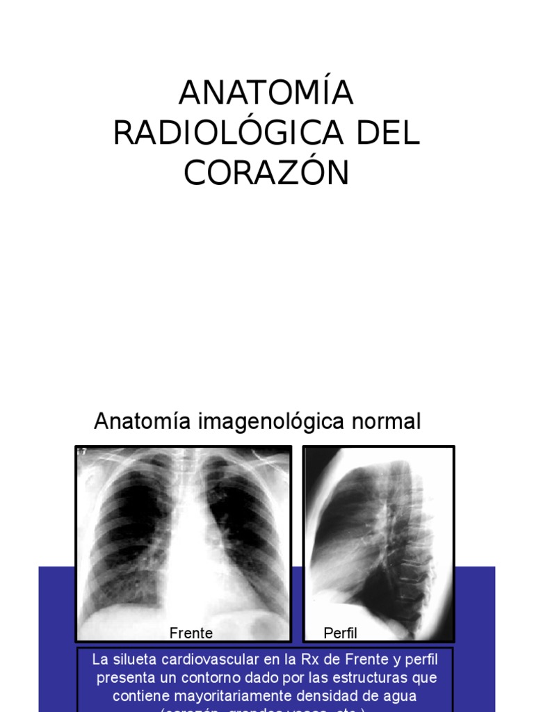 Anatomía Radiológica Del Corazón | PDF | Corazón | Sistema circulatorio