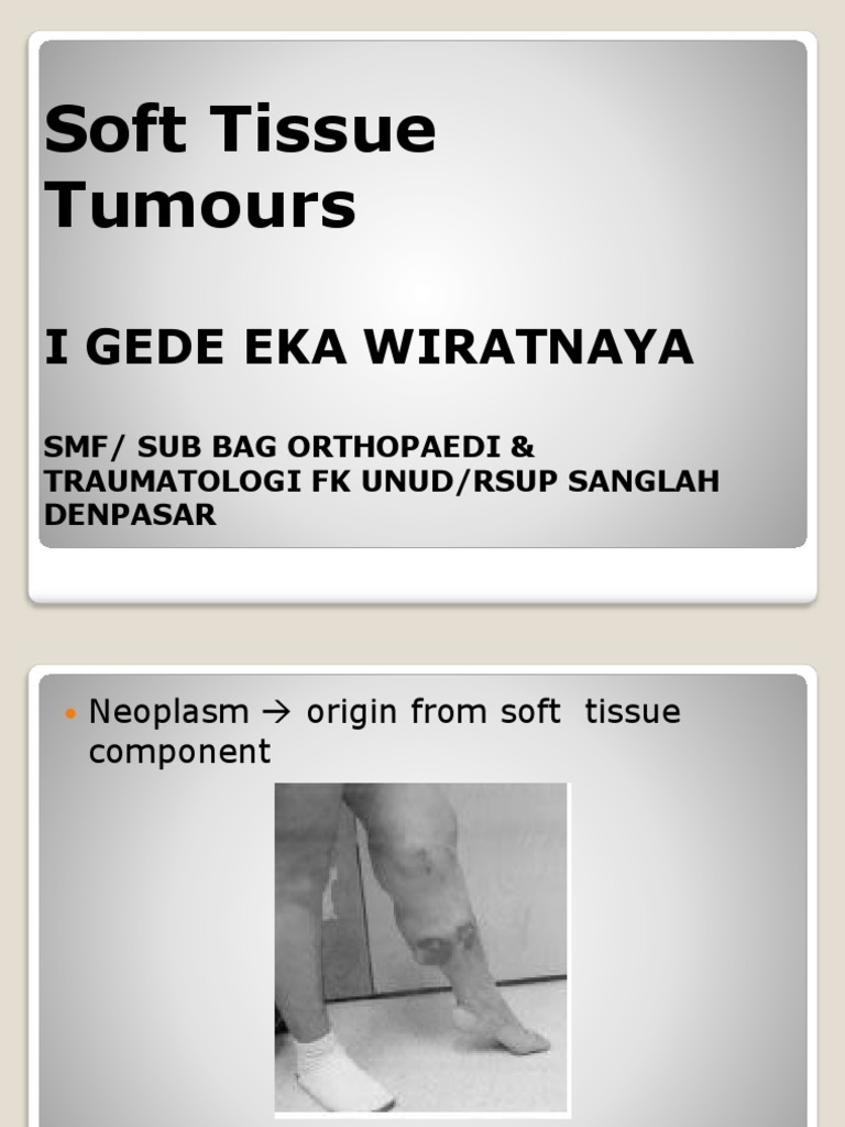 Soft Tissue Tumors Overview and Management | PDF | Neoplasms | Benign Tumor