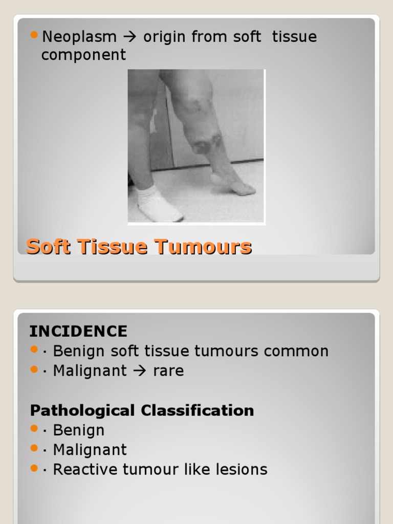 Soft Tissue Tumours | PDF | Benign Tumor | Neoplasms
