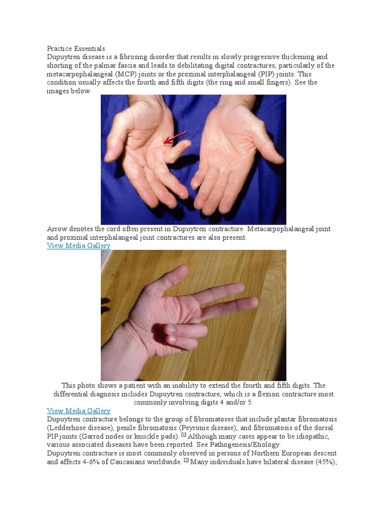 An In-Depth Review of the Stages, Grading, Anatomy, and Pathogenesis of ...