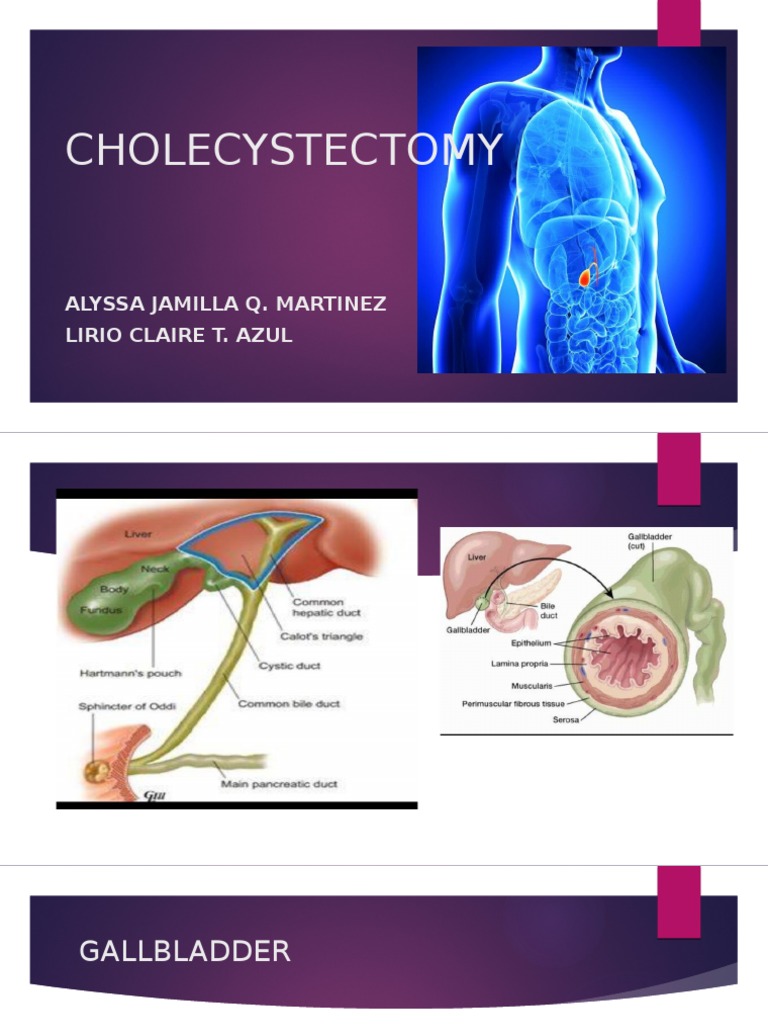 Cholecystectomy | PDF | Gallbladder | Abdomen