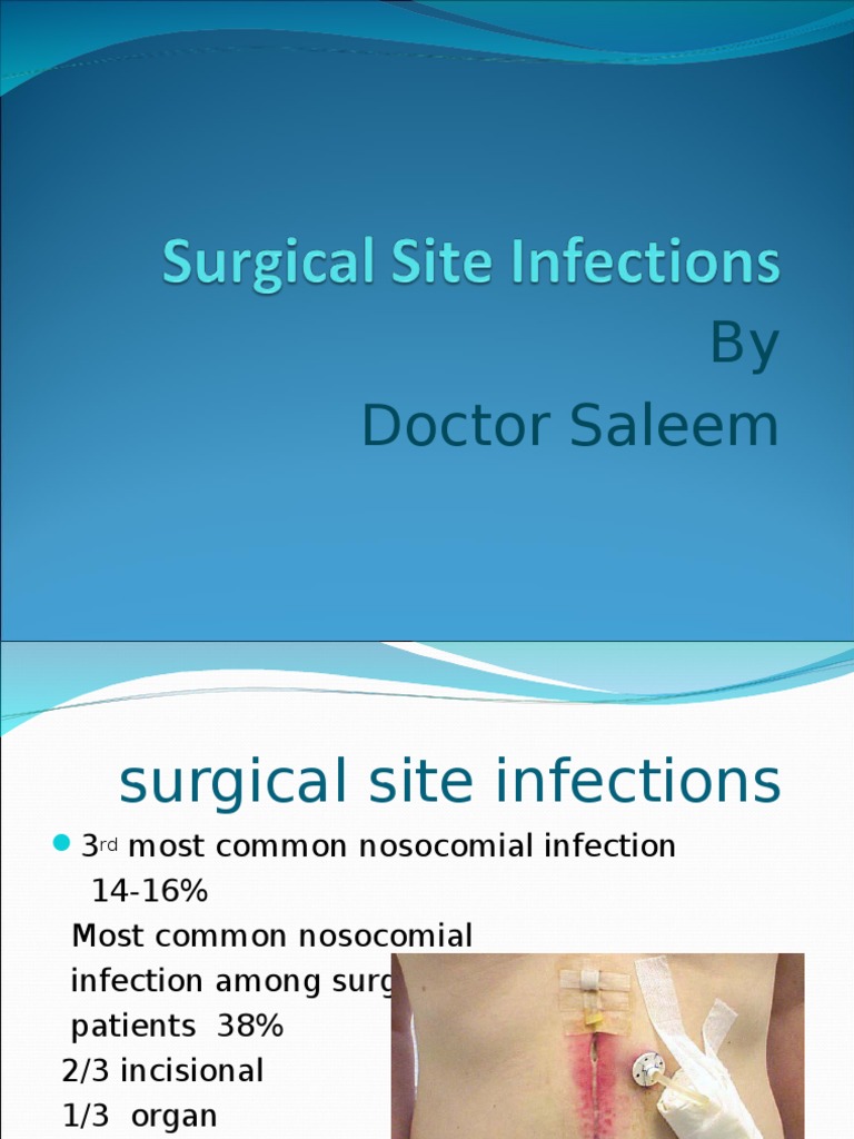 Ssi Presentation 1226839149141241 9 | PDF | Surgery | Wound