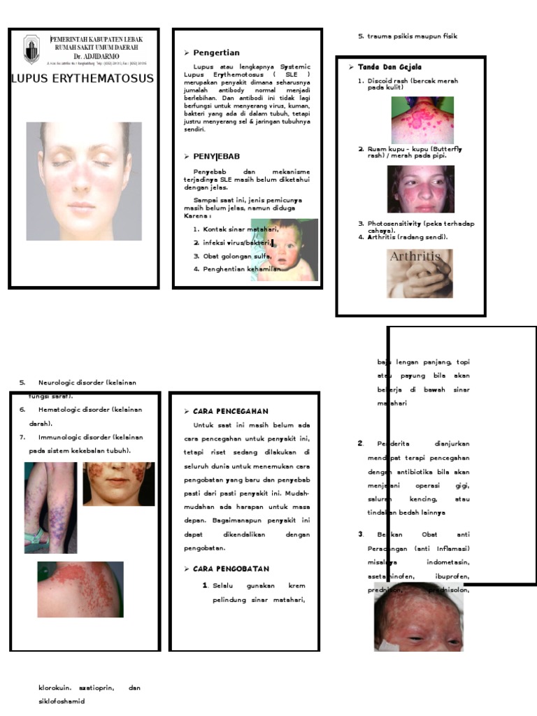 Leaflet Lupus | PDF