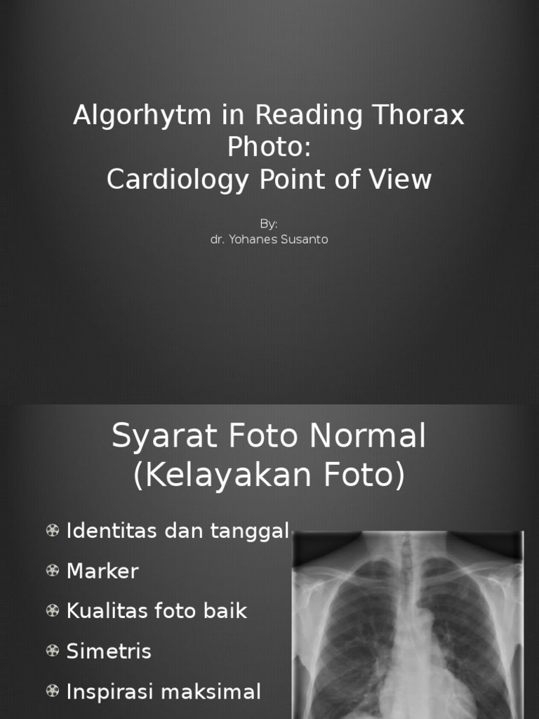 Baca Foto Thorax Normal | PDF