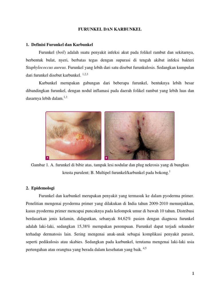 FURUNKEL Lapsus Revisi 3 | PDF