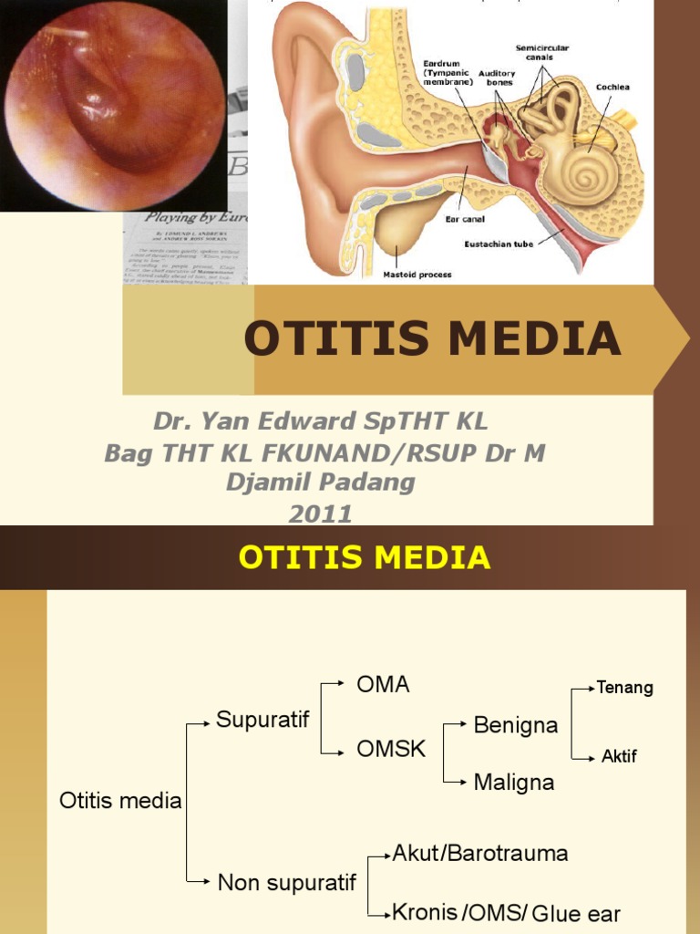 Otitis Media: Types and Treatments | PDF