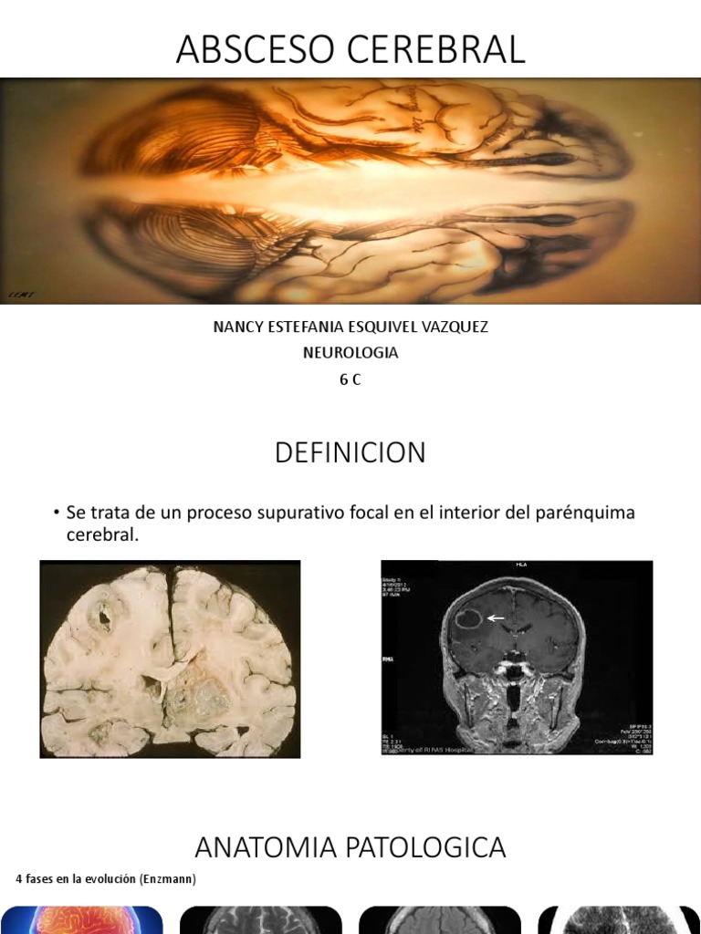 Absceso Cerebral | PDF | Desórdenes neurológicos | Enfermedades y ...
