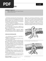 Cirugia de Hartmann | PDF | Cáncer colonrectal | Cirugía