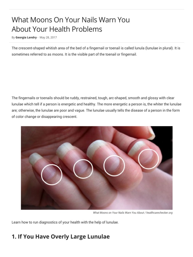 Lunula | PDF | Nail (Anatomy) | Circulatory System