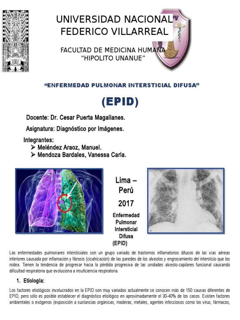 Enfermedad Pulmonar Intersticial Difusa | Neumonía | Diagnostico medico