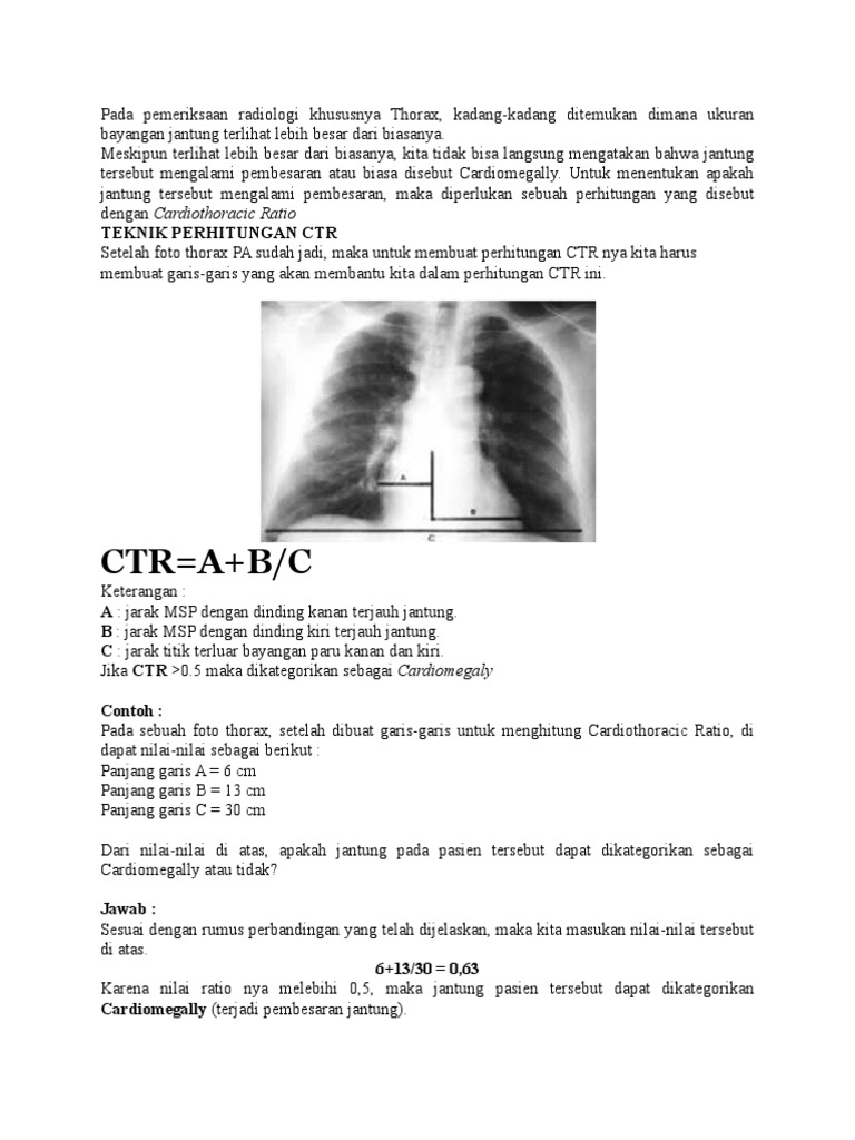 CTR Jantung | PDF