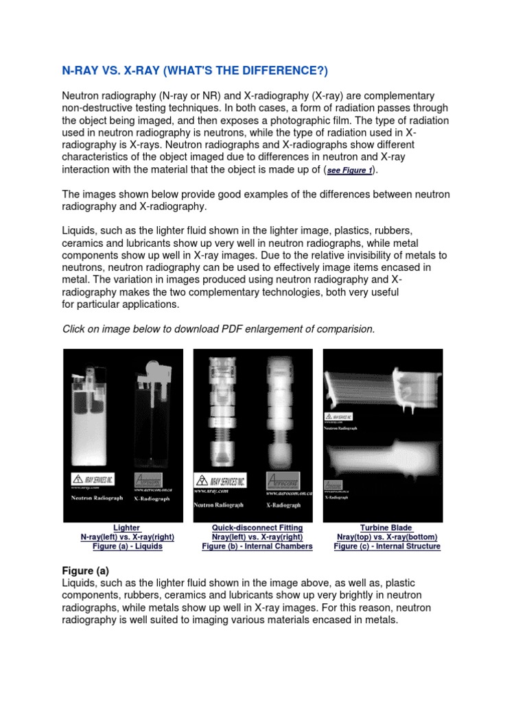 N-Ray vs. X-Ray (What'S The Difference?) : Click On Image Below To ...